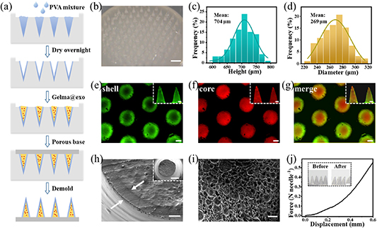 Breathable core–shell microneedle patches for diabetic wound treatment ...