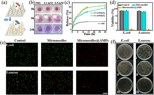 Breathable core–shell microneedle patches for diabetic wound treatment ...