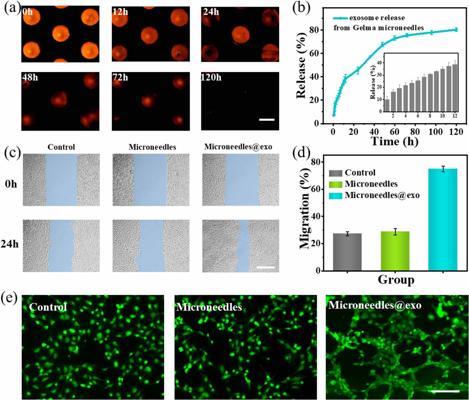 Breathable core–shell microneedle patches for diabetic wound treatment ...