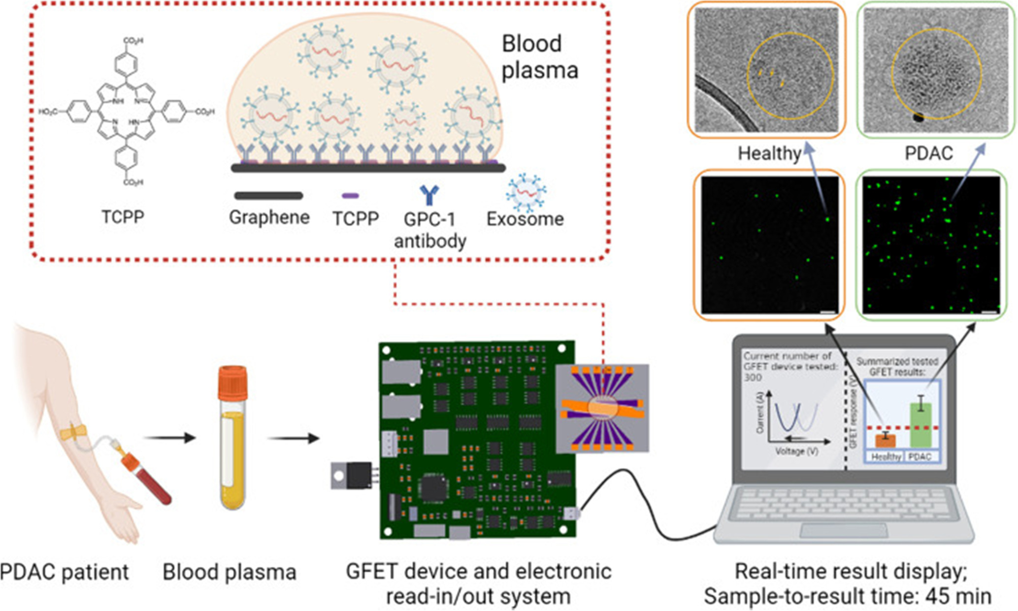 Review—Prospects in Cancer Diagnosis: Exosome-Chip for Liquid Biopsy ...